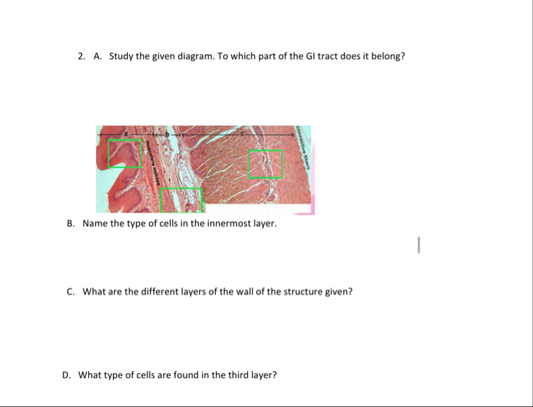 Solved A. ﻿Study the given diagram. To which part of the GI | Chegg.com