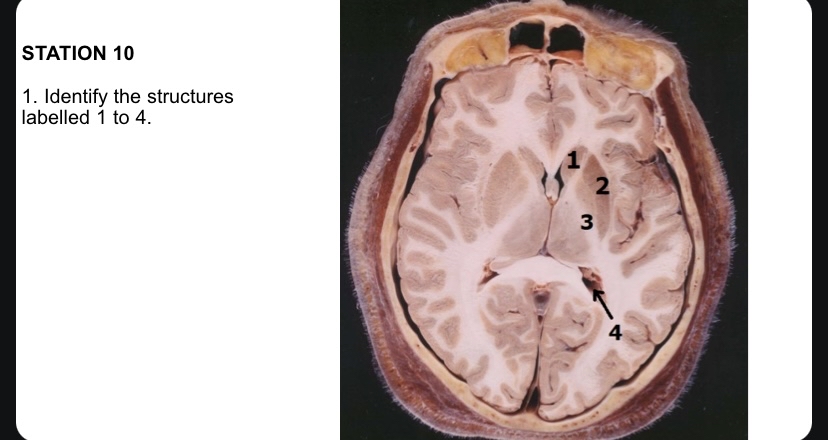 Solved STATION 10Identify the structures labelled 1 ﻿to 4 . | Chegg.com