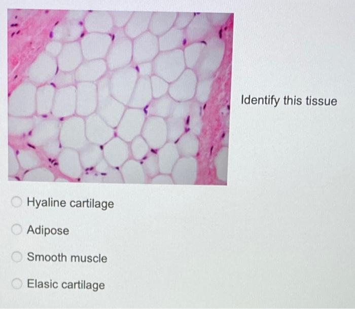 Solved Identify this tissue Hyaline cartilage Adipose Smooth | Chegg.com