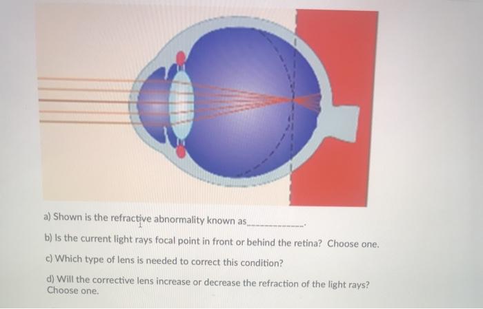 Solved a) Shown is the refractive abnormality known as b) Is | Chegg.com