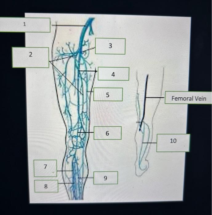 Solved Identify the following lower extremity veins: | Chegg.com