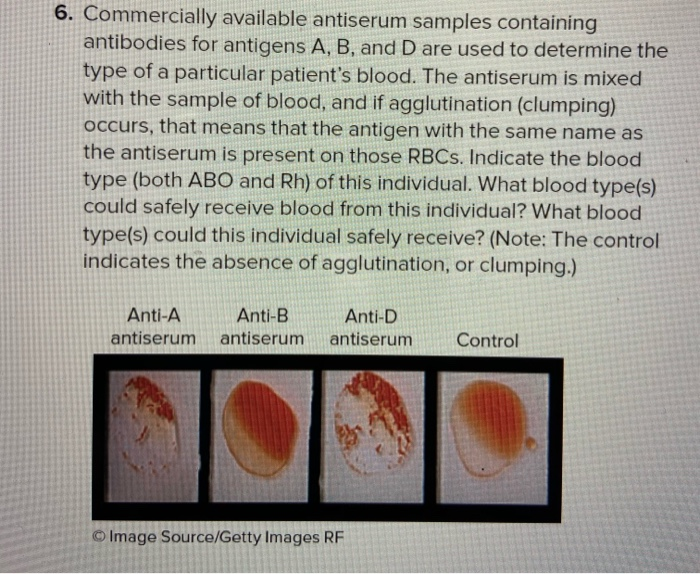 Solved 6. Commercially available antiserum samples | Chegg.com