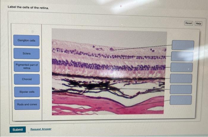 Solved Label the cells of the retina. | Chegg.com