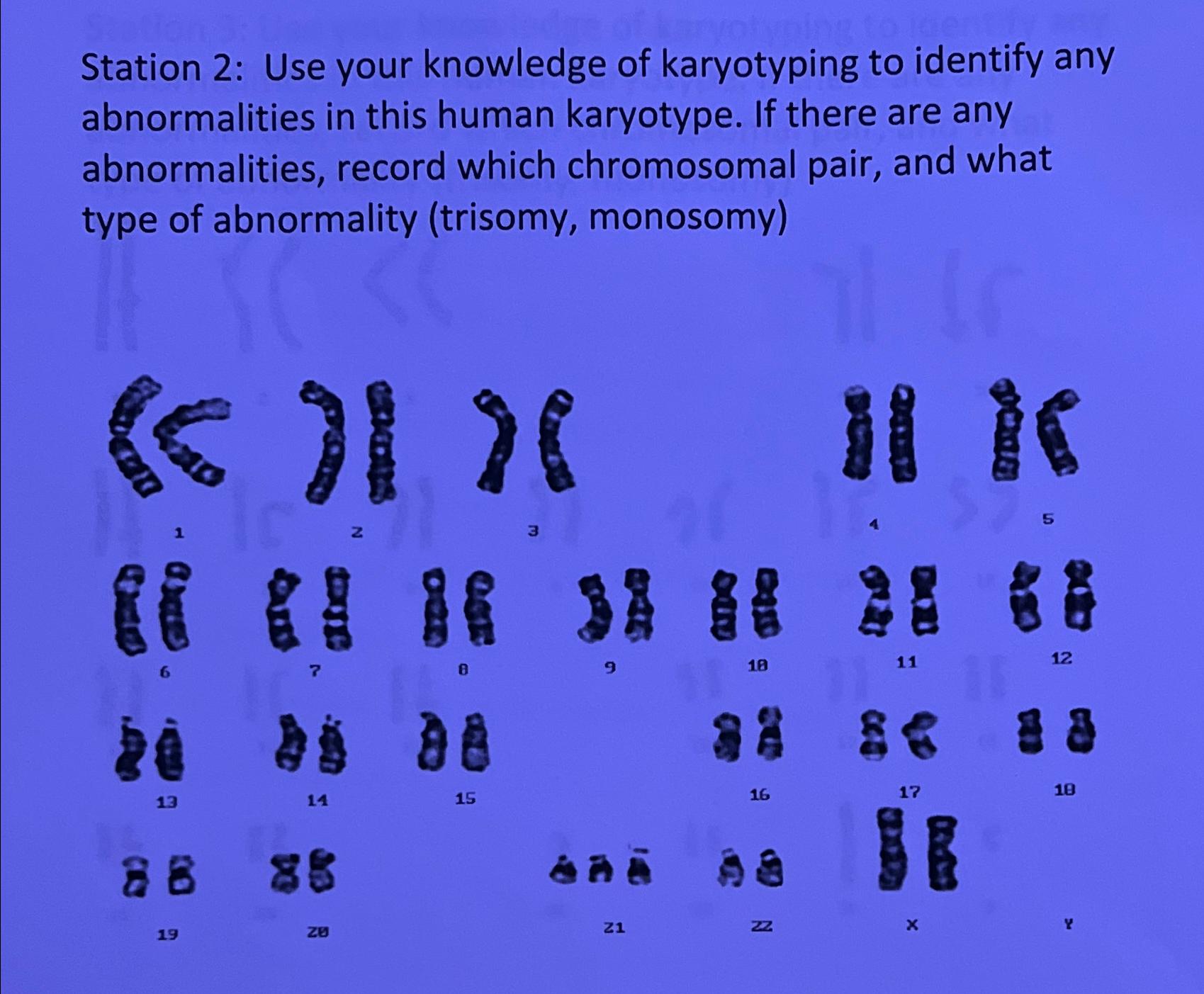 Solved Station 2: Use your knowledge of karyotyping to | Chegg.com
