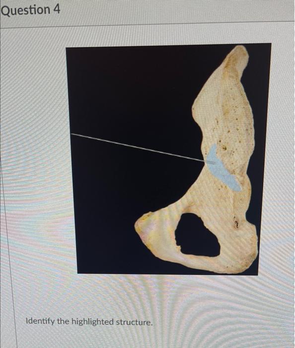 Solved Identify the highlighted structure. | Chegg.com
