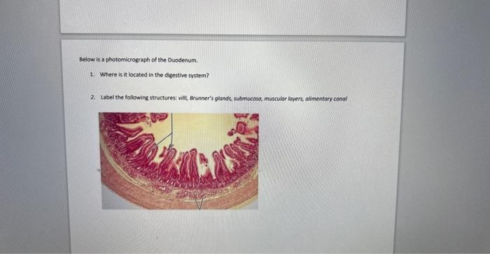 Below is a photomicrograph of the Duodenum. 1. Where | Chegg.com