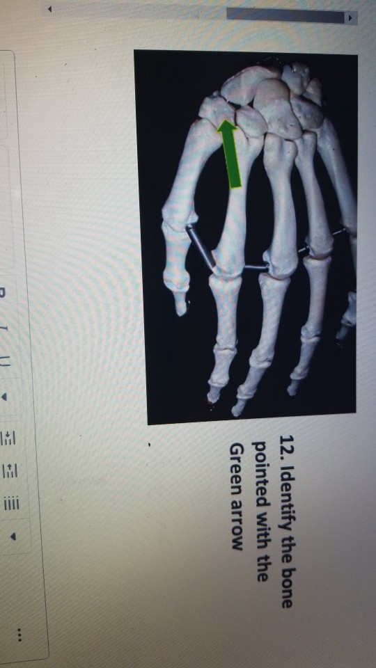 Solved 9. Identify the bone - 10. Identify the bone 11. | Chegg.com