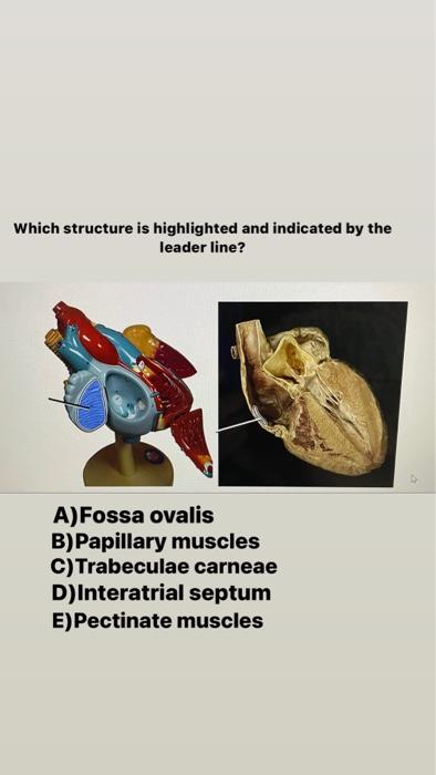 Solved What structure is highlighted and indicated by the | Chegg.com