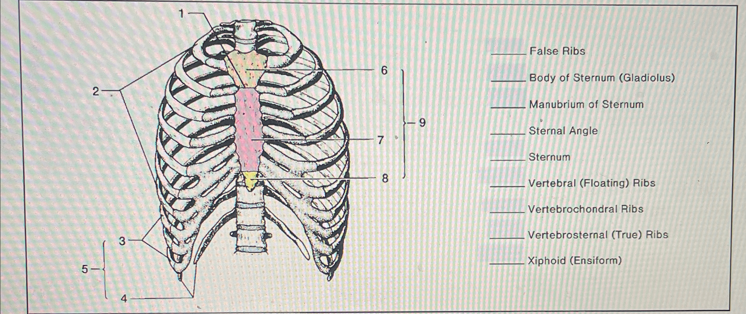 Solved ﻿False RibsBody of Sternum (Gladiolus)Manubrium of | Chegg.com