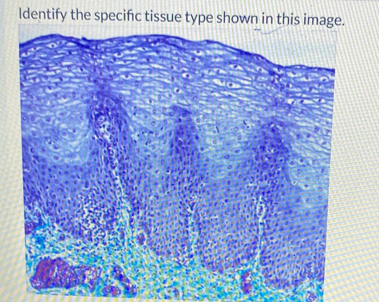 Solved Identify the specific tissue type shown in this | Chegg.com