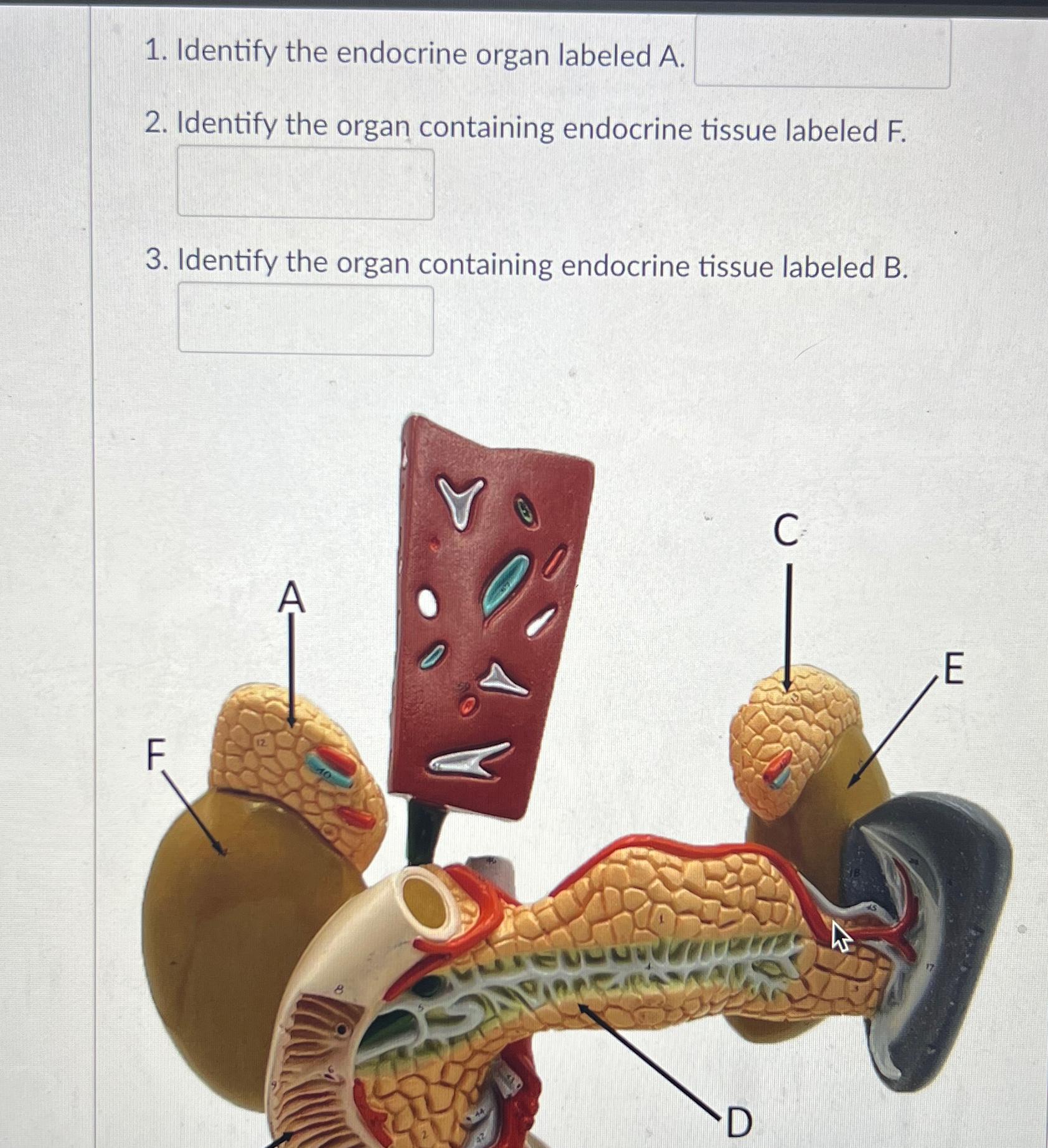 Solved Identify the endocrine organ labeled A.Identify the | Chegg.com