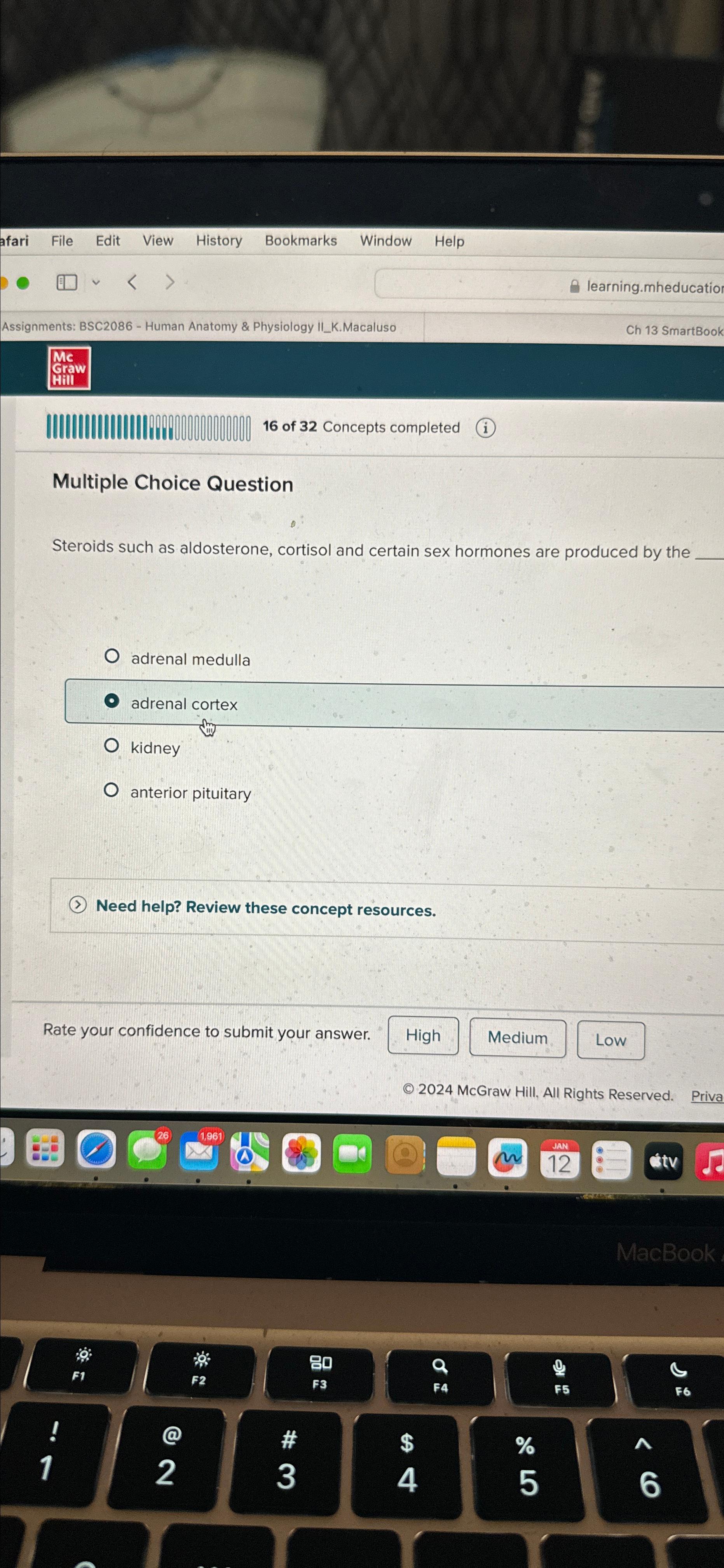 16-of-32-concepts-completed-i-multiple-choice-chegg