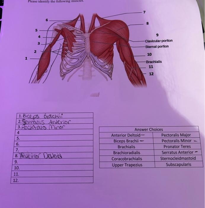 Solved Upper Extremity Anatomy (word banks under answer | Chegg.com