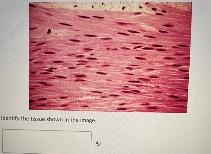 Solved Identify the tissue shown in the image. Where in | Chegg.com