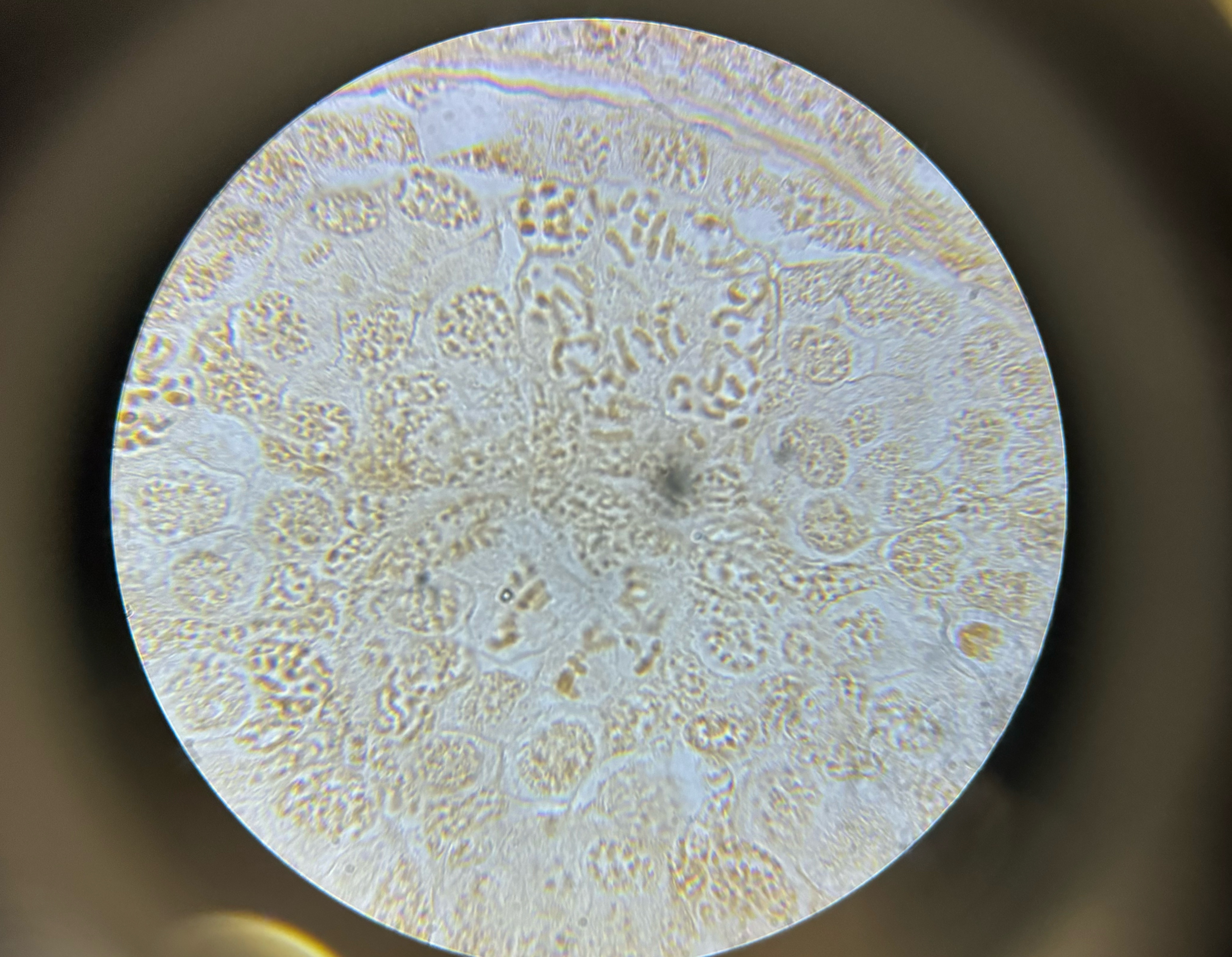 Solved Label the meiosis I and meiosis II observed in this | Chegg.com