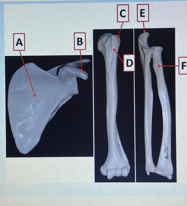 Solved Name 1 muscle that attaches to the landmark labelled | Chegg.com