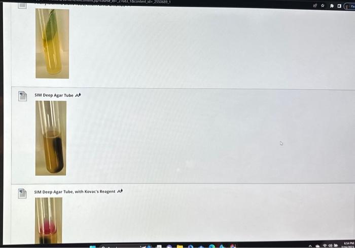 Solved Nutrient Agar, Culture Growth Gram stain Crystal | Chegg.com