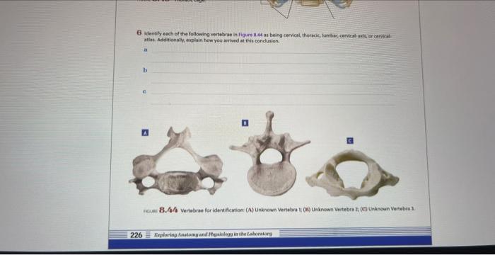 Solved Identify each of the following vertebrae in Figure | Chegg.com