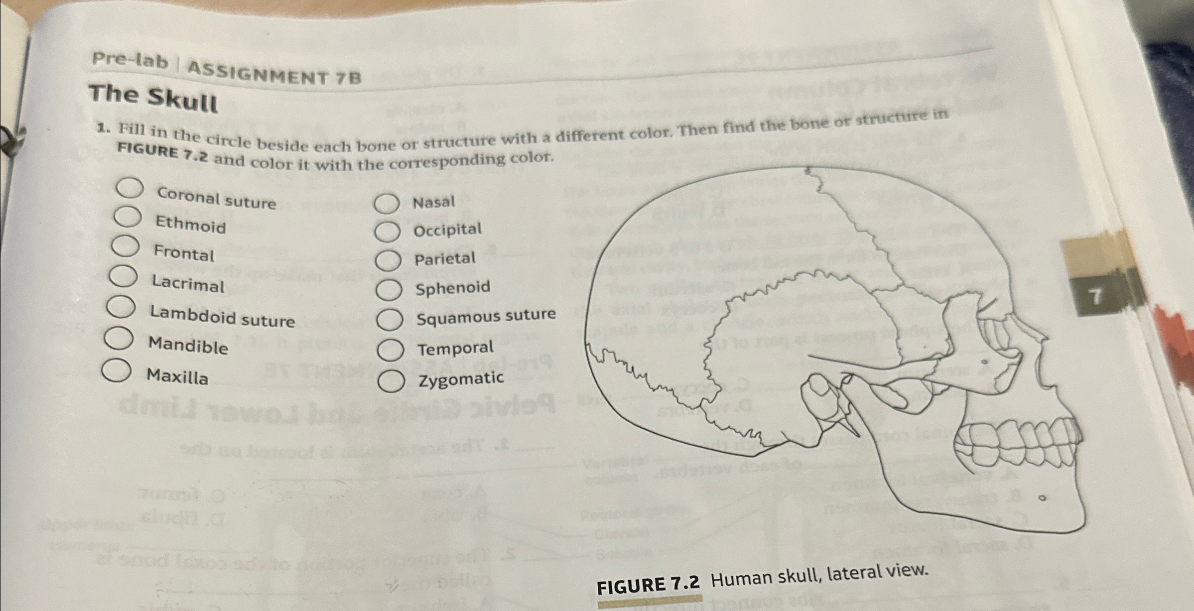 Solved Pre-lab ASSIGNMENT 7 ﻿BThe SkullFill in the circle | Chegg.com