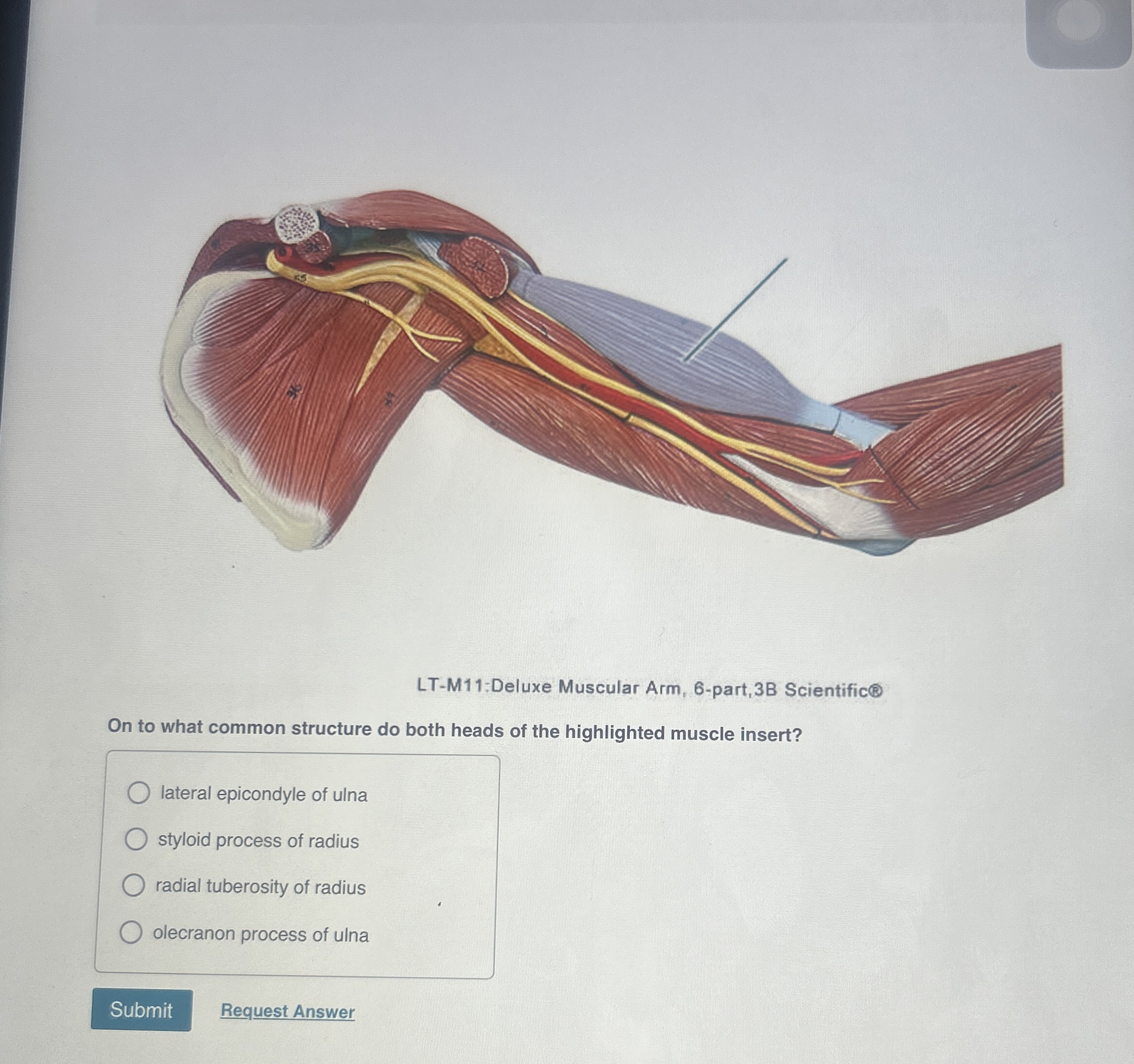 Solved LT-M11:Deluxe Muscular Arm, 6-part,3B ScientificOn to | Chegg.com