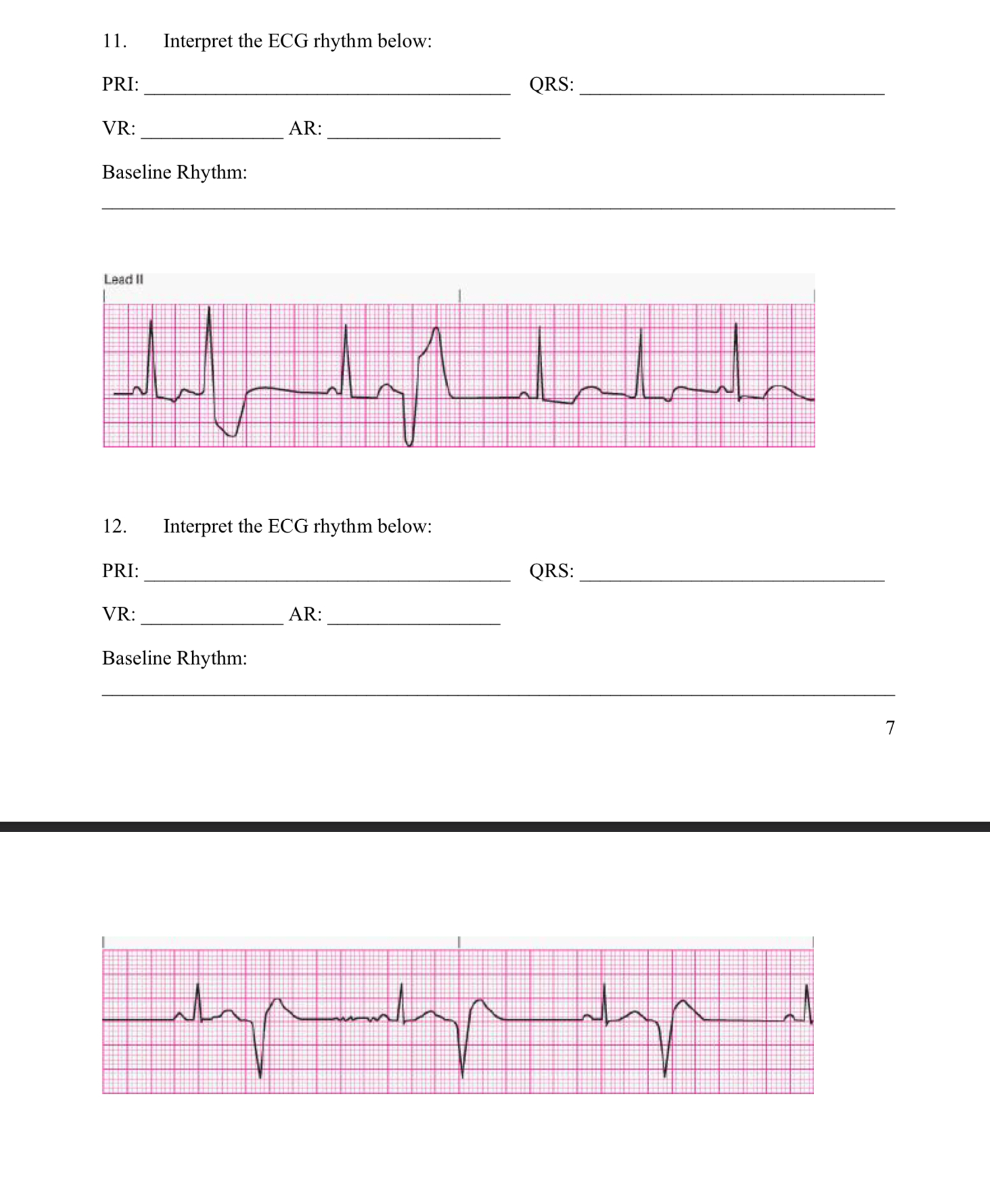 Solved Interpret the ECG rhythm below:PRI:QRS:VR:AR:Baseline | Chegg.com