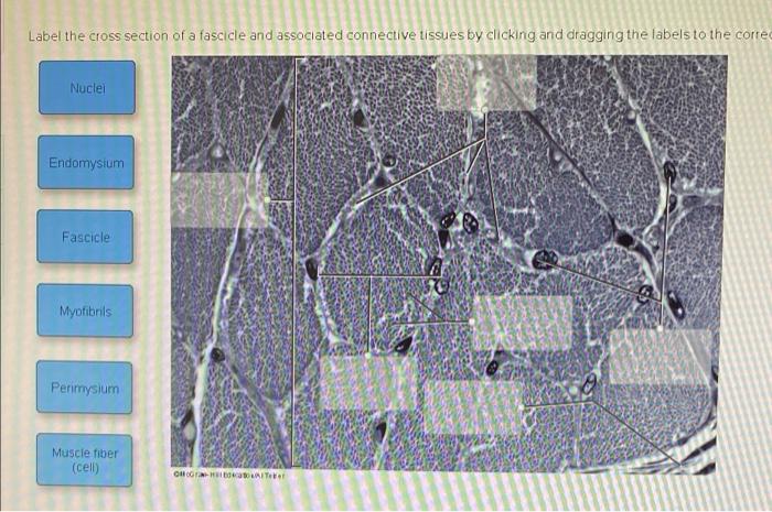 Solved Label the cross section of a fascide and associated | Chegg.com