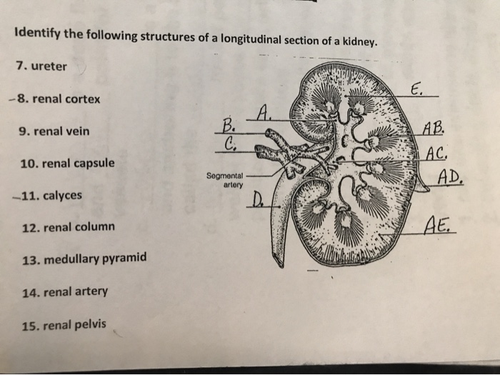 Solved Identify the following structures of a longitudinal | Chegg.com