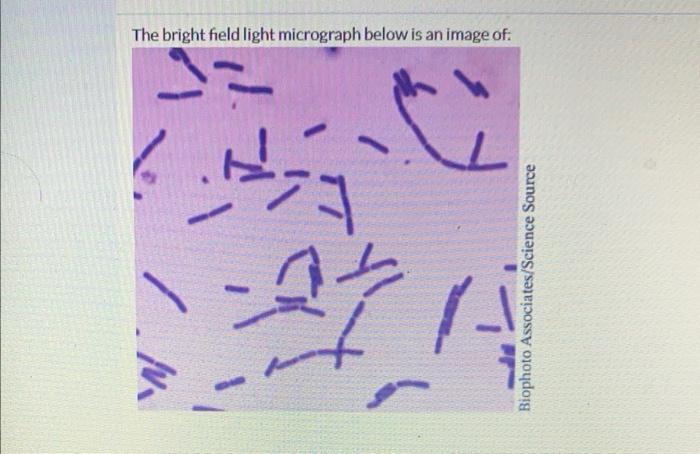Solved The bright field light micrograph below is an image | Chegg.com