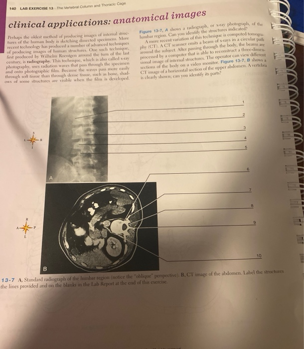 Solved 140 LAB EXERCISE 13 The Vertebral Column and Thoracio | Chegg.com