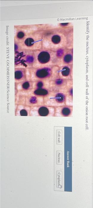 Identify the nucleus, cytoplasm, and cell wall of the | Chegg.com