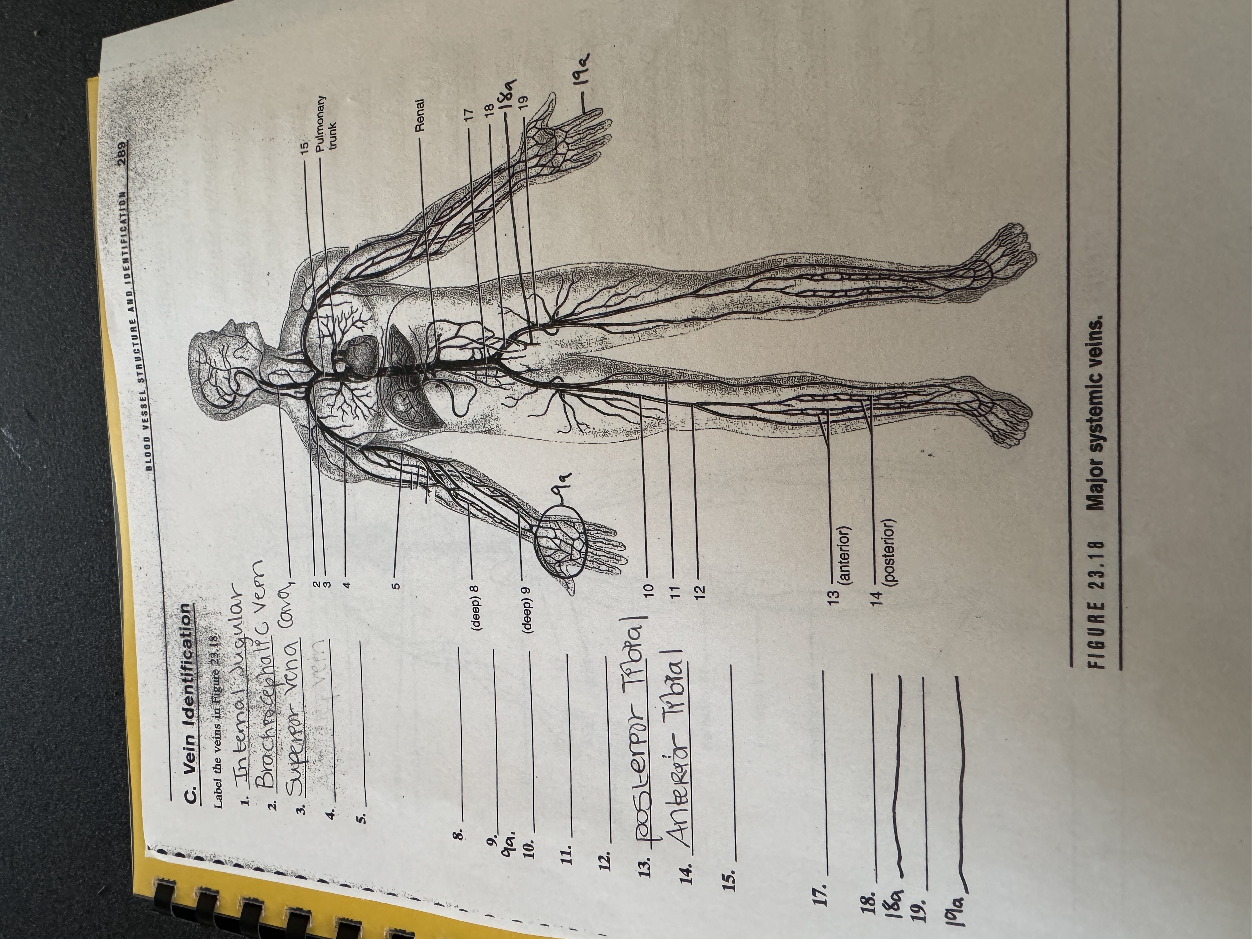 Solved C. ﻿Vein IdentificationLabel the veins in tifinte | Chegg.com