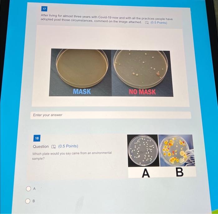 Solved Microbial Populations: Ubiquity I and II Hi, | Chegg.com
