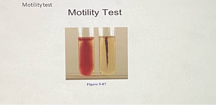 Solved 1. Breve of micro C Moes of micro Doree 2. Motility | Chegg.com