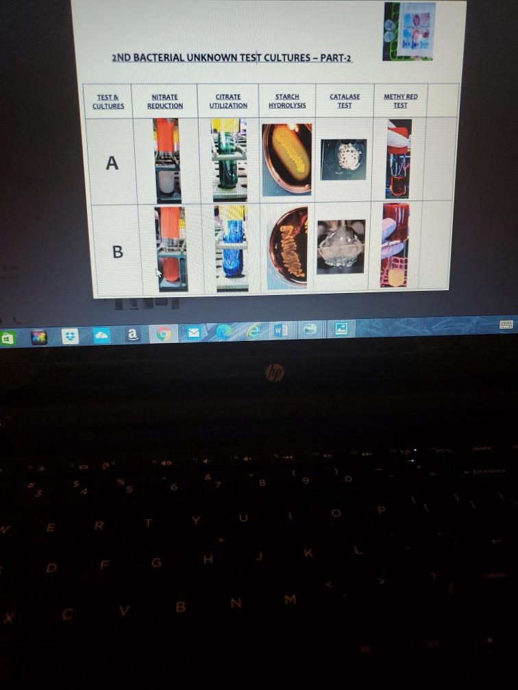 Solved 00 2ND BACTERIAL UNKNOWN TEST CULTURES (PART 1) | Chegg.com