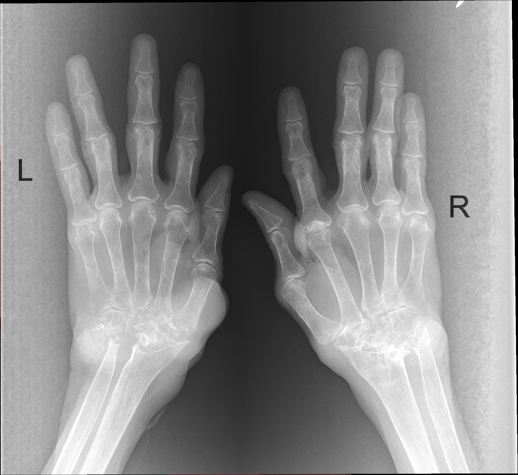Solved This case is - 50 ﻿yo female presenting with | Chegg.com