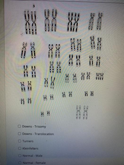 Solved DIE SEED ILIH CUE 9 N CDC DEX 1 Downs - Trisomy Downs | Chegg.com
