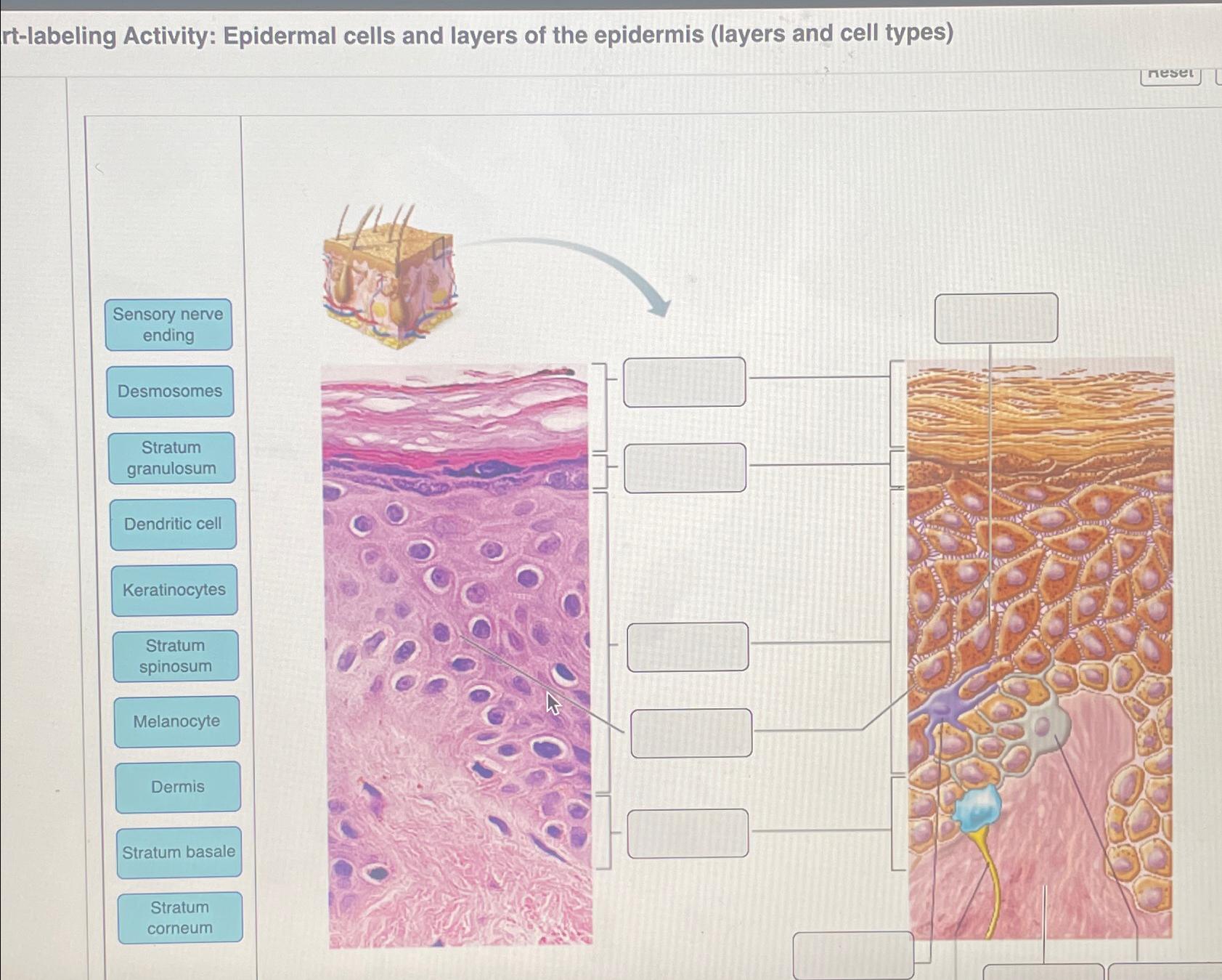 Solved it-labeling Activity: Epidermal cells and layers of | Chegg.com