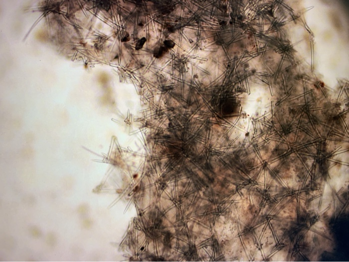 Solved Picture of spicules under a microscope:a. How many | Chegg.com