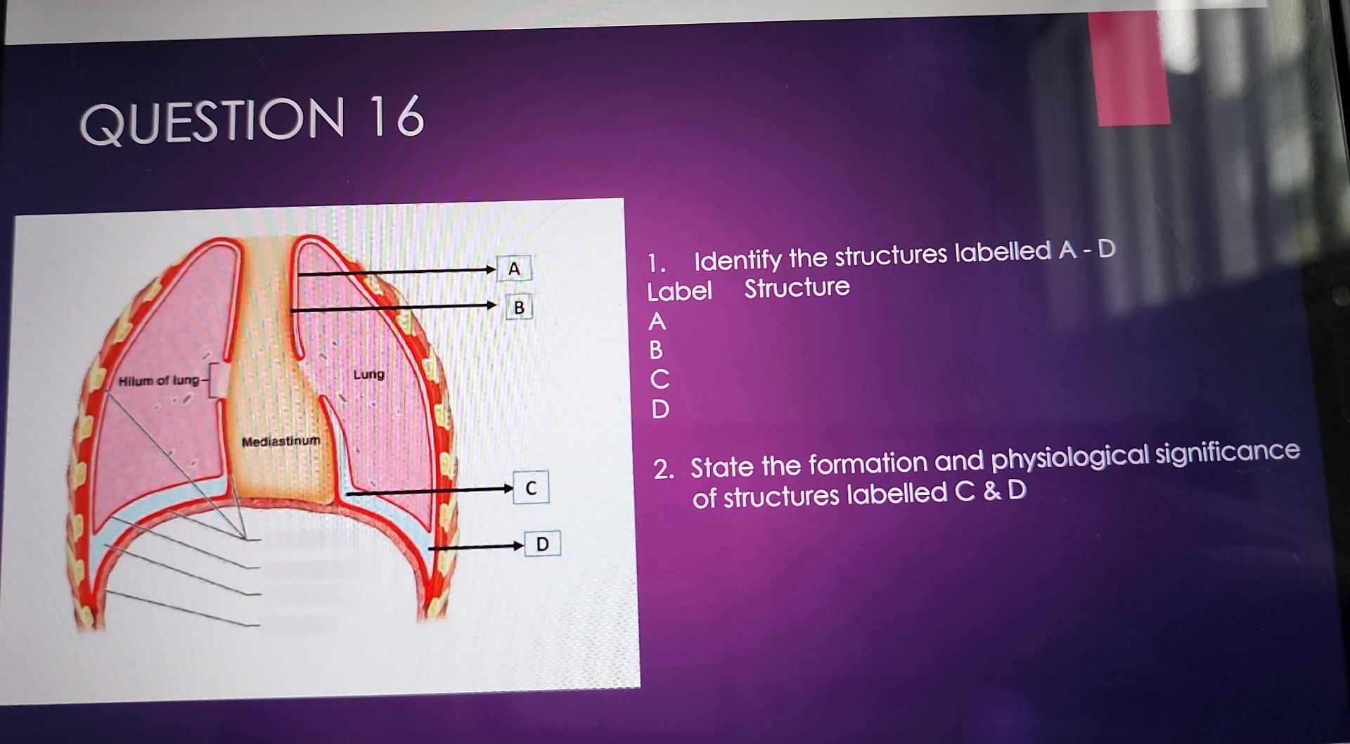 Solved QUESTION 16 1. Identify the structures labelled A - D | Chegg.com