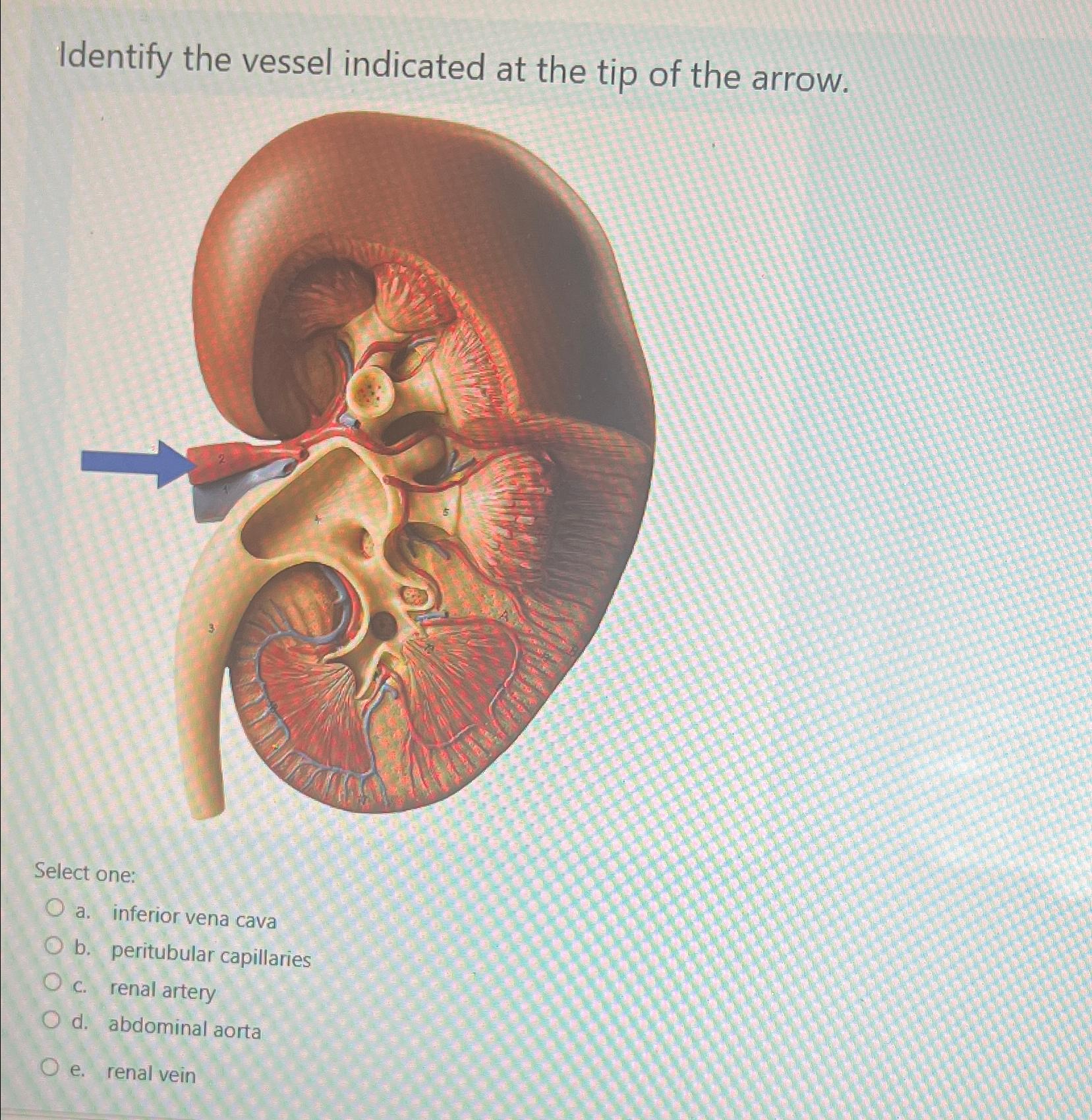 Solved Identify the vessel indicated at the tip of the | Chegg.com