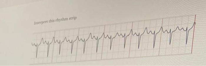 Solved Interpree this rhythm strip | Chegg.com