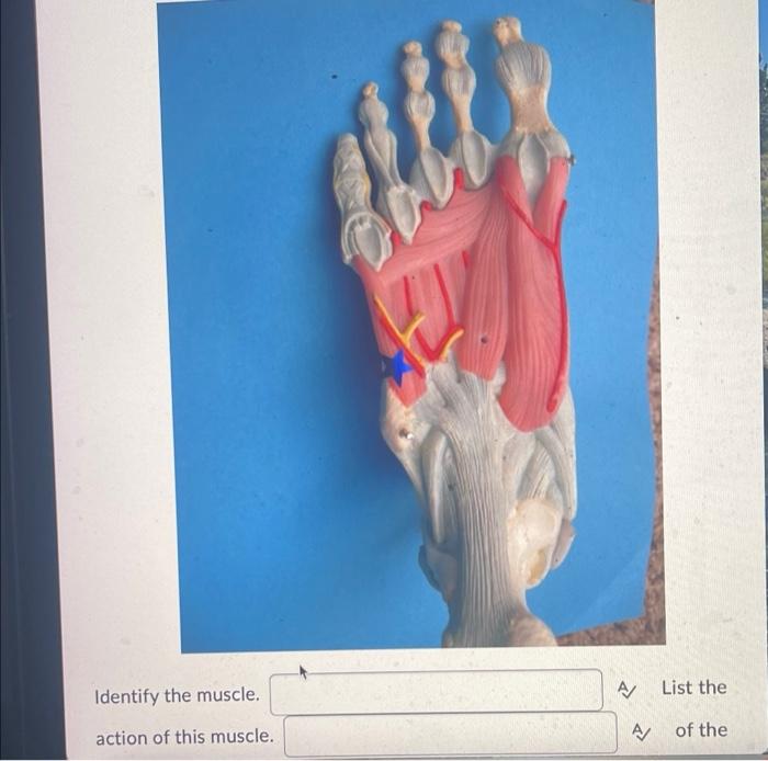 Solved 1. Identify the muscle2. List the action of this | Chegg.com