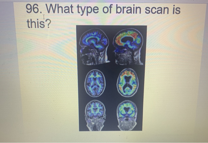 Solved 96. What type of brain scan is this? | Chegg.com