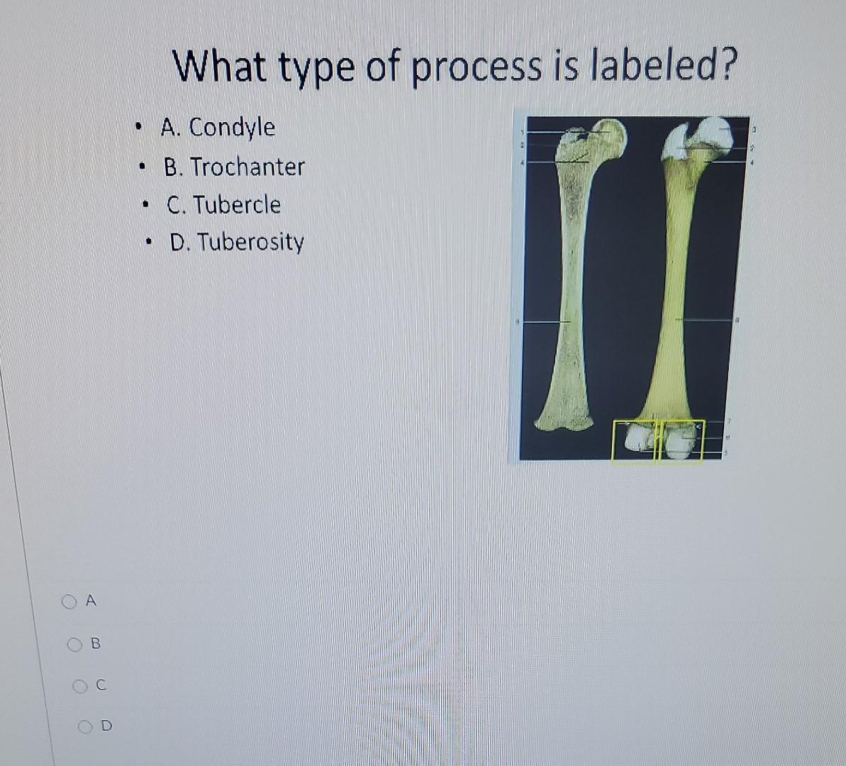 Solved What type of process is labeled? - A. Condyle - B. | Chegg.com