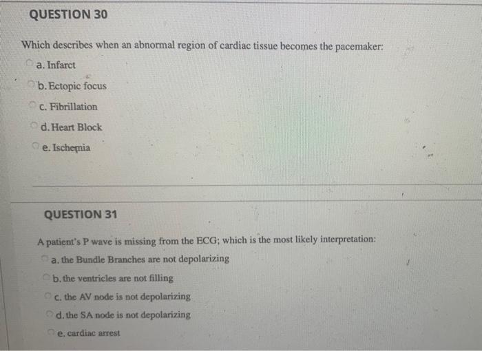 Solved Which describes when an abnormal region of cardiac | Chegg.com