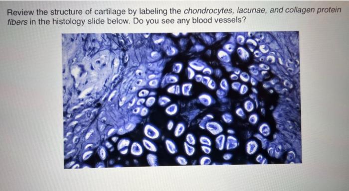 Solved Review the structure of cartilage by labeling the | Chegg.com