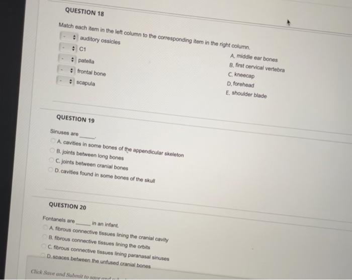 Solved Match each item in the left column to the | Chegg.com