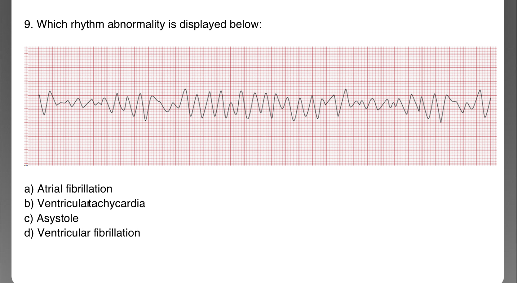 Solved Which rhythm abnormality is displayed below:a) | Chegg.com