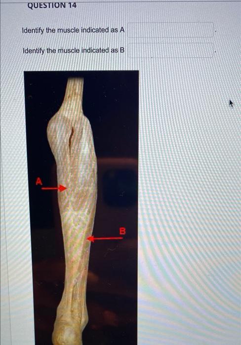 Solved QUESTION 9 Identify the muscle indicated as A | Chegg.com