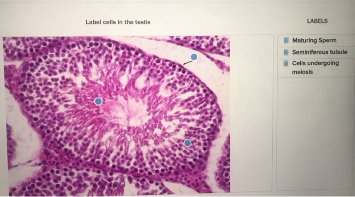 Solved Label cells in the testis LABELS Maturing Sperm | Chegg.com